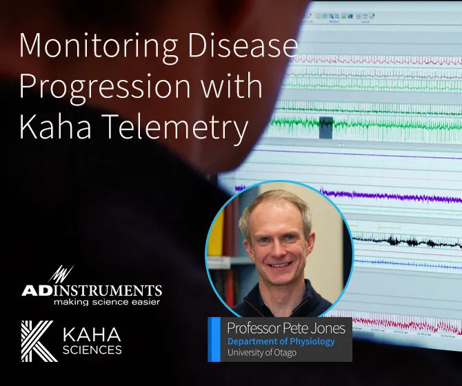 ADInstruments Blog | ADInstruments